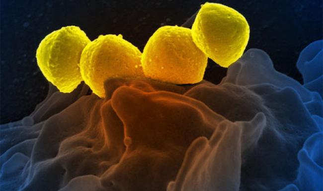 Streptoderma huis behandeling vir kinders en volwassenes